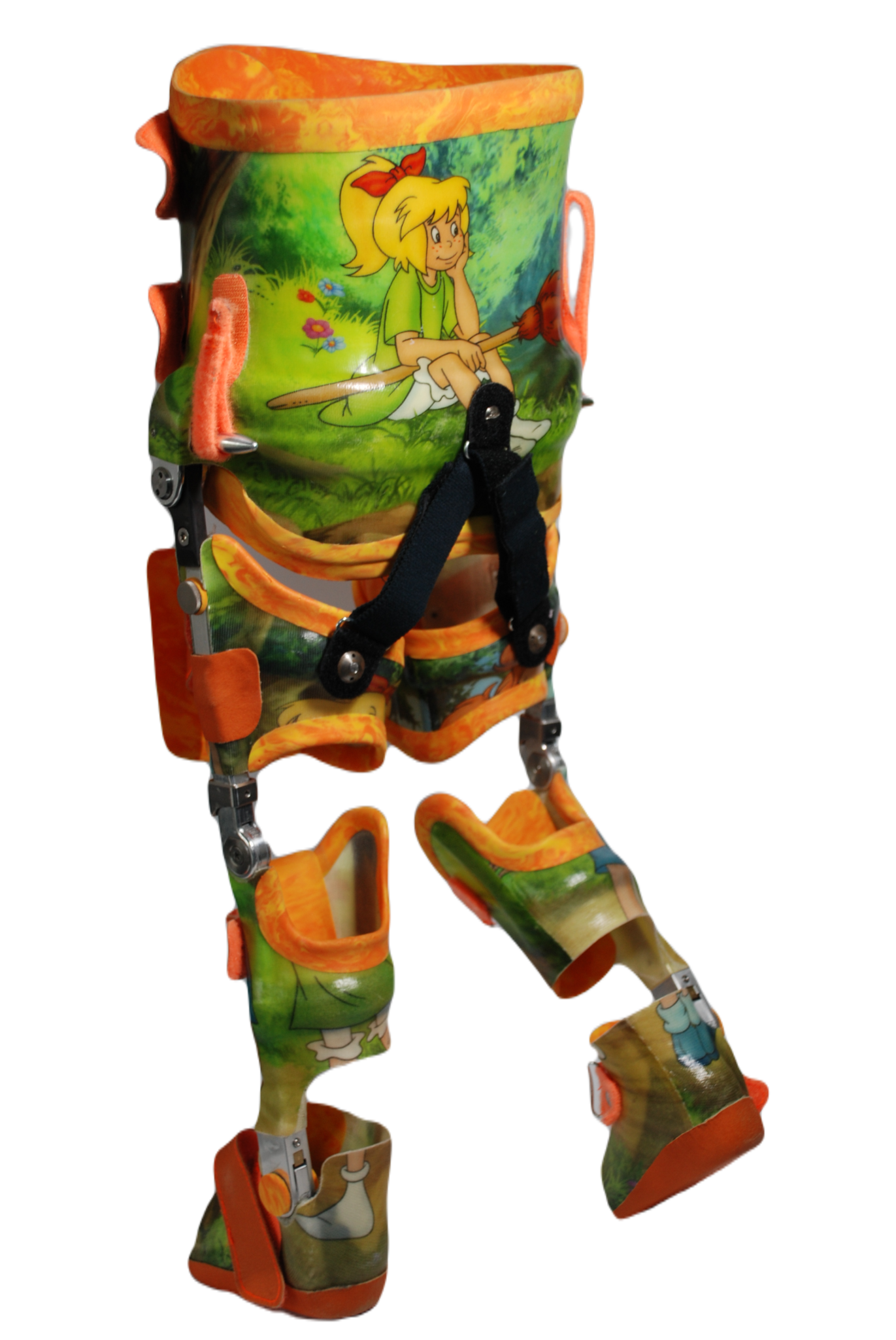 Spina bifida (MMC): Ursachen, Symptome & Behandlung - PhysioTEC